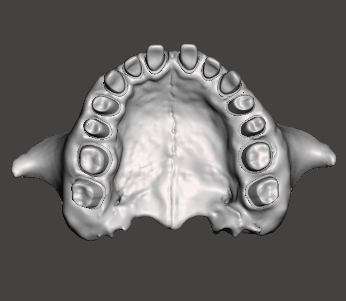 Human maxillary jaw with typodont 3D print model