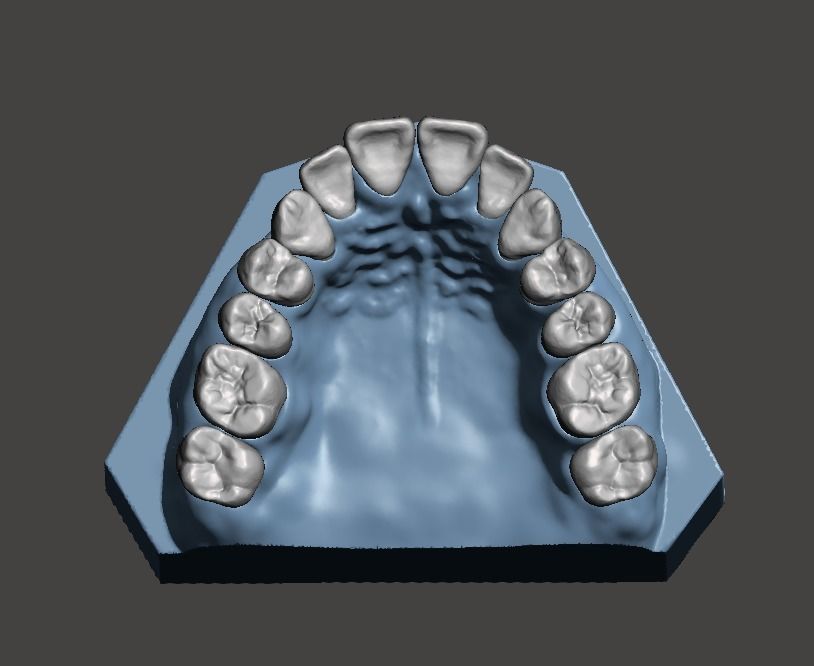 D001 Dental Sample model 3D model 3D printable | CGTrader