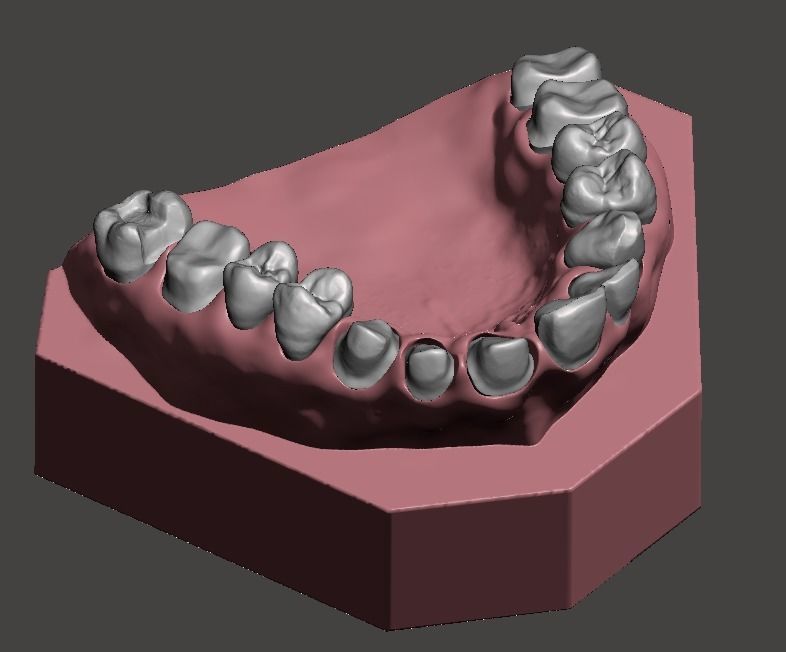 D001 Dental Sample model 3D model 3D printable | CGTrader