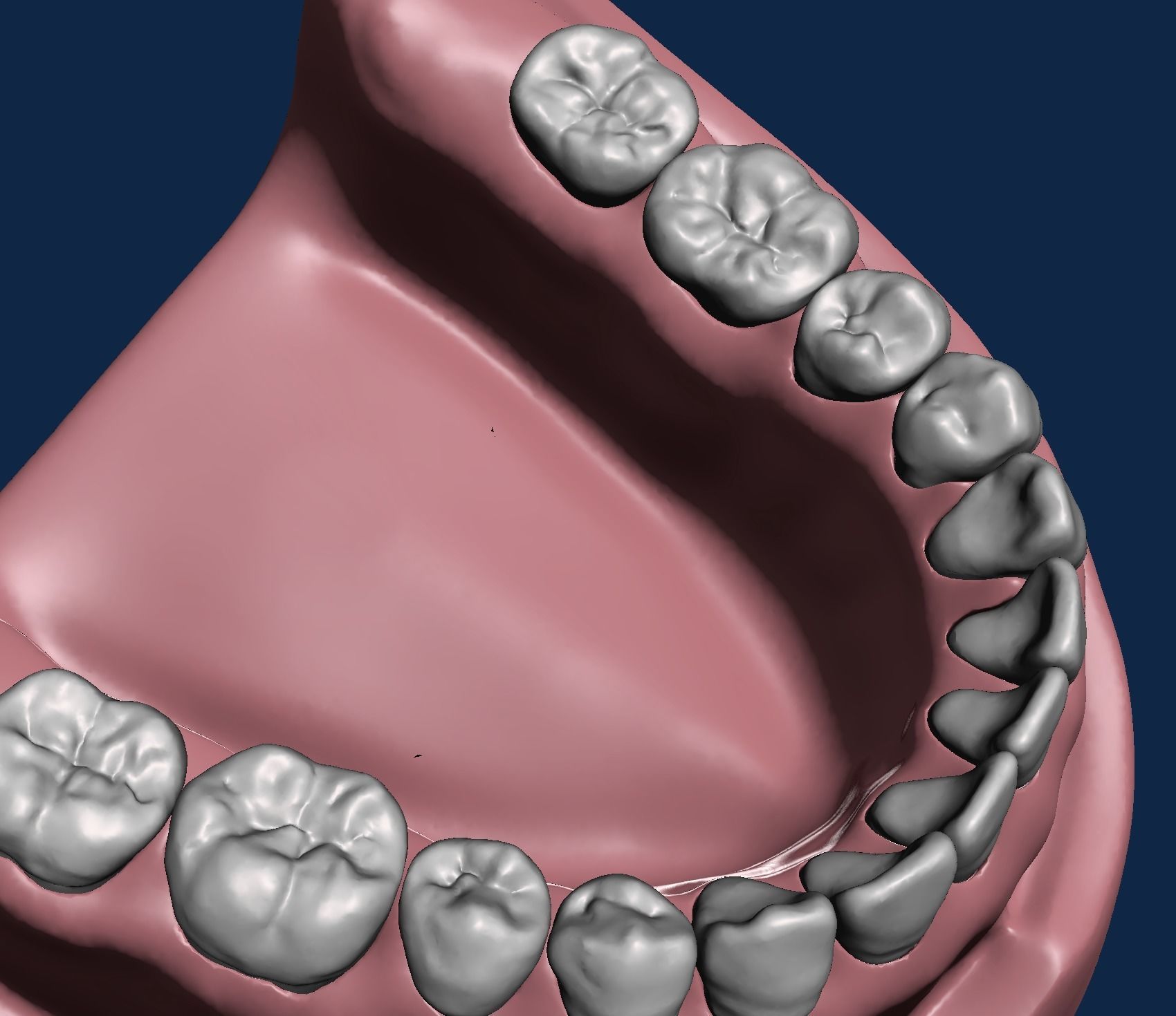D003 Dental model with natural anatomy typodonts 3D model 3D printable ...