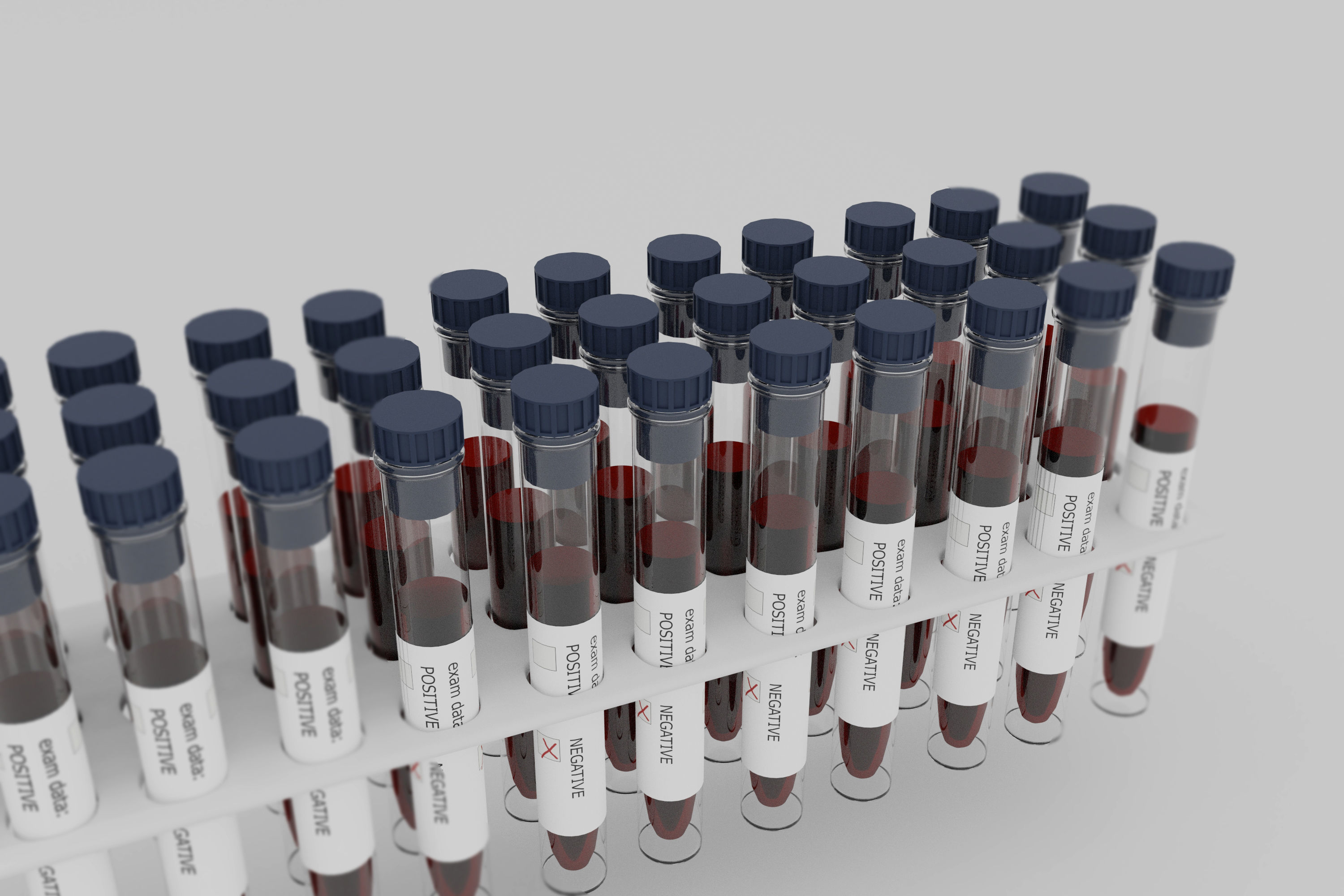 3D model Blood test tubes VR / AR / low-poly | CGTrader