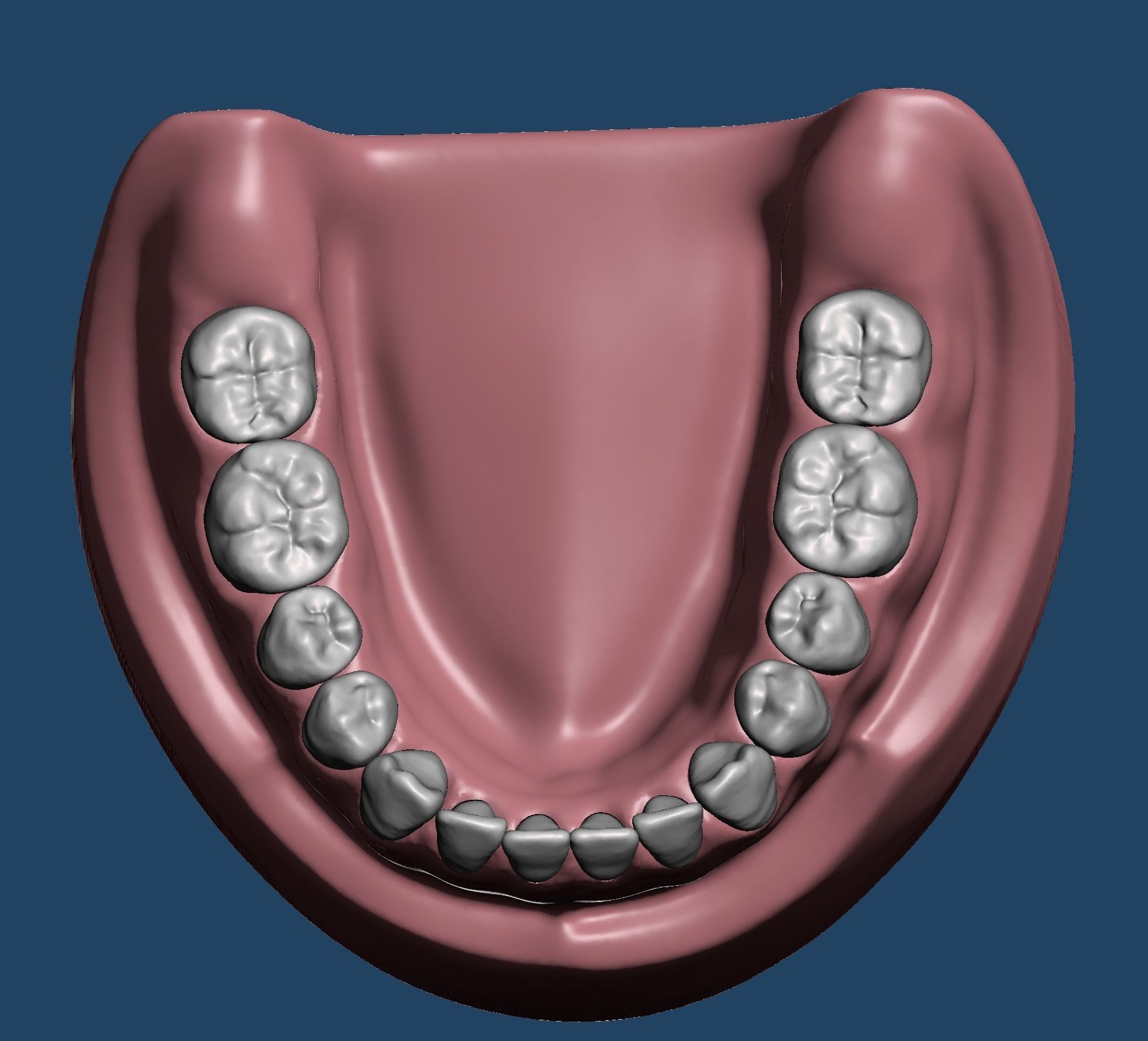 Dental Sample model 3D model 3D printable | CGTrader