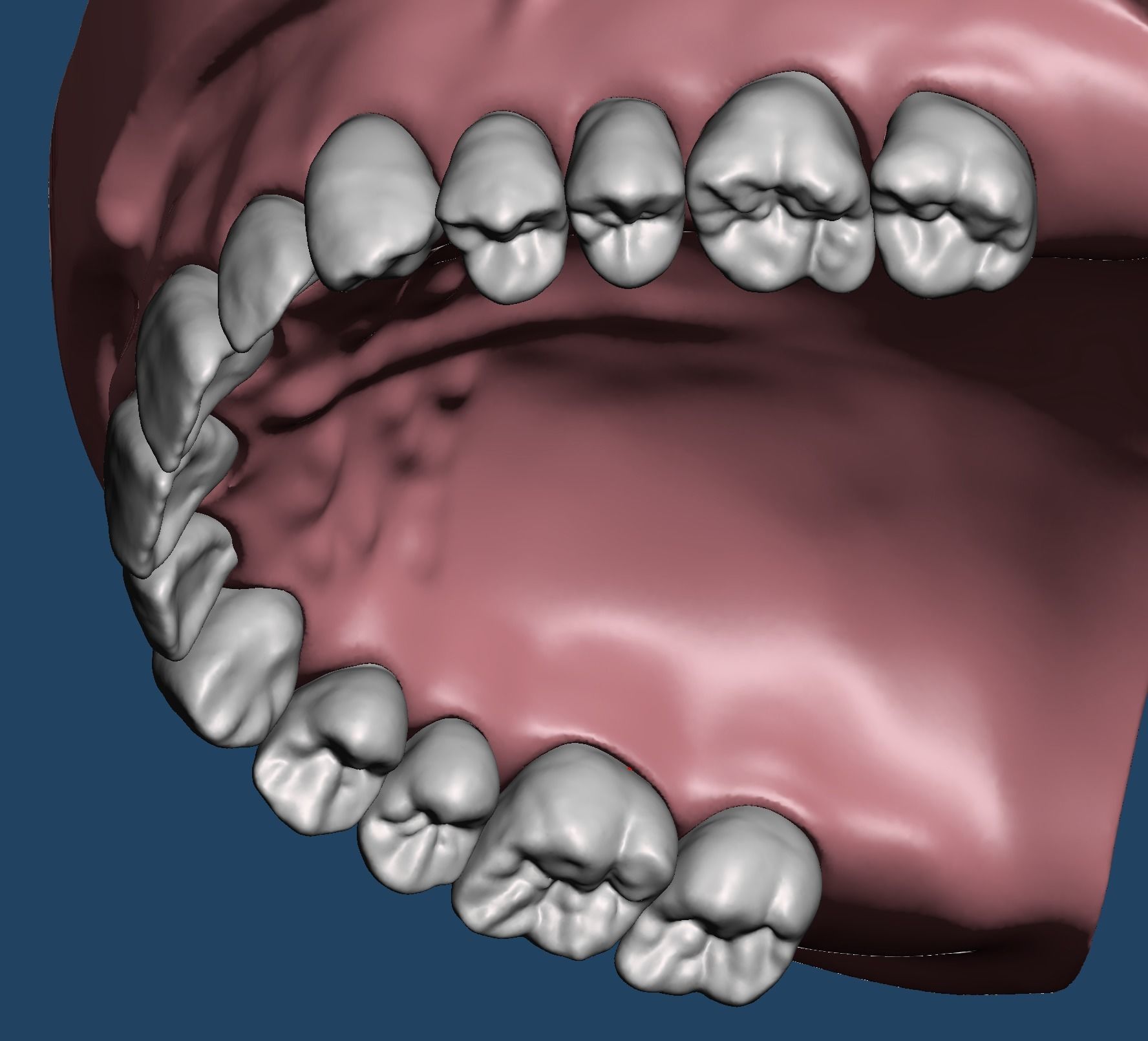 Dental Sample model 3D model 3D printable | CGTrader