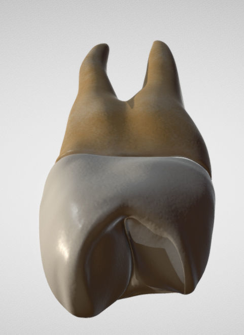 3D model Maxillary First Premolar VR / AR / low-poly | CGTrader