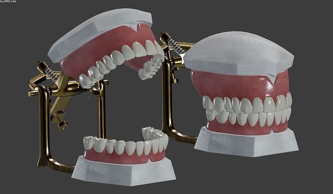 Dental Prosthesis 3D model animated | CGTrader