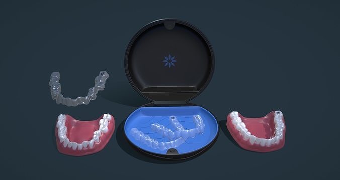 Teeth aligner Invisible Braces and jaw 3D model animated | CGTrader
