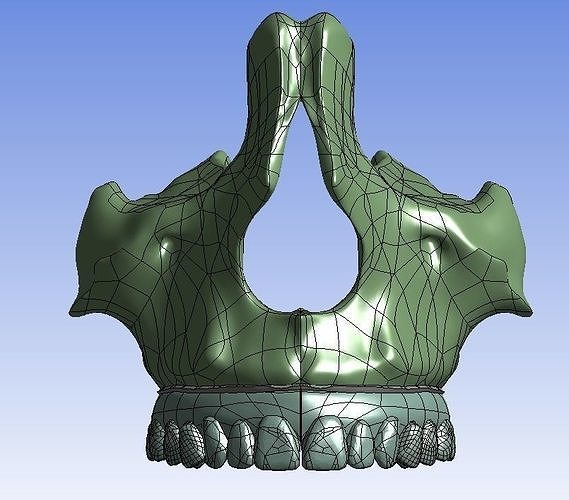 maxilla all-on-four 3D model | CGTrader