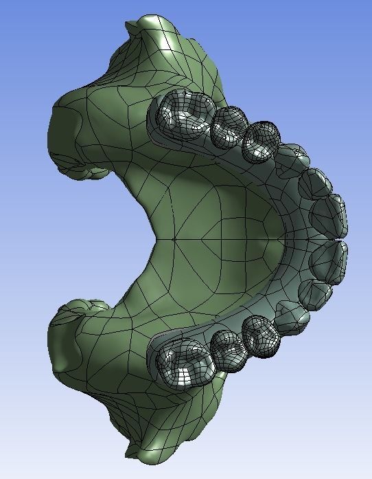 maxilla all-on-four 3D model | CGTrader