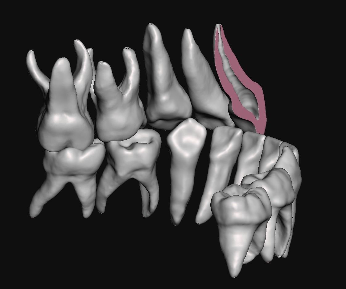 Primary teeth anatomy model 3D model 3D printable | CGTrader