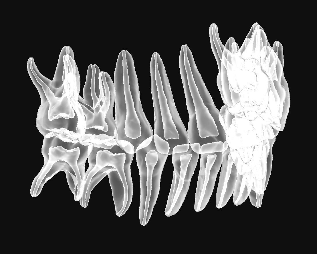 Primary teeth anatomy model 3D model 3D printable | CGTrader