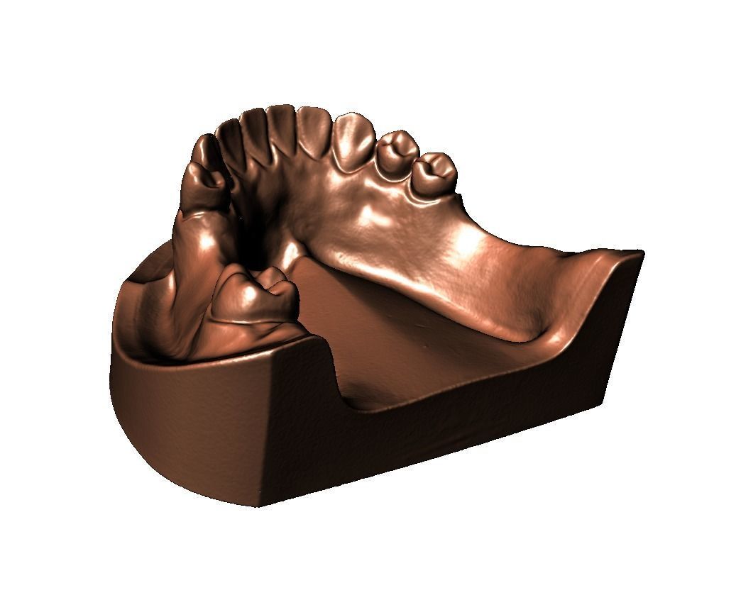 3D model Dental Model rpd cast upper lower VR / AR / low-poly | CGTrader