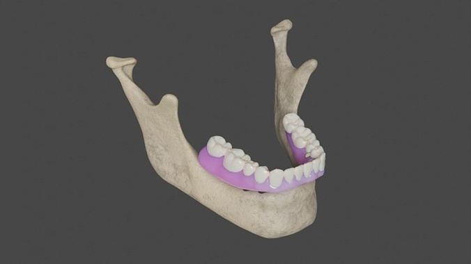 Full arch fixed implant-supported prostheses - Lower arch 3D model ...