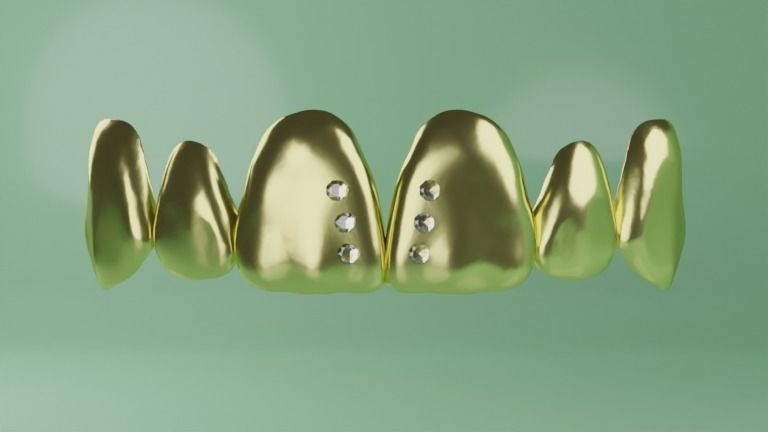 Grillz with diamonds in the front teeth 3D model | CGTrader