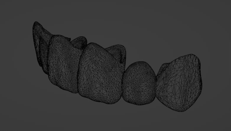 Grillz with textured teeth - gold 3D model | CGTrader