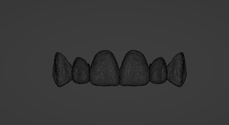 Grillz with textured teeth - gold 3D model | CGTrader
