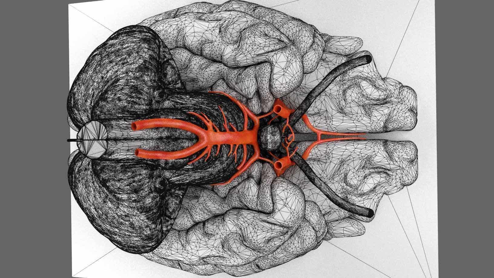 CIRCLE OF WILLIS 3D model | CGTrader