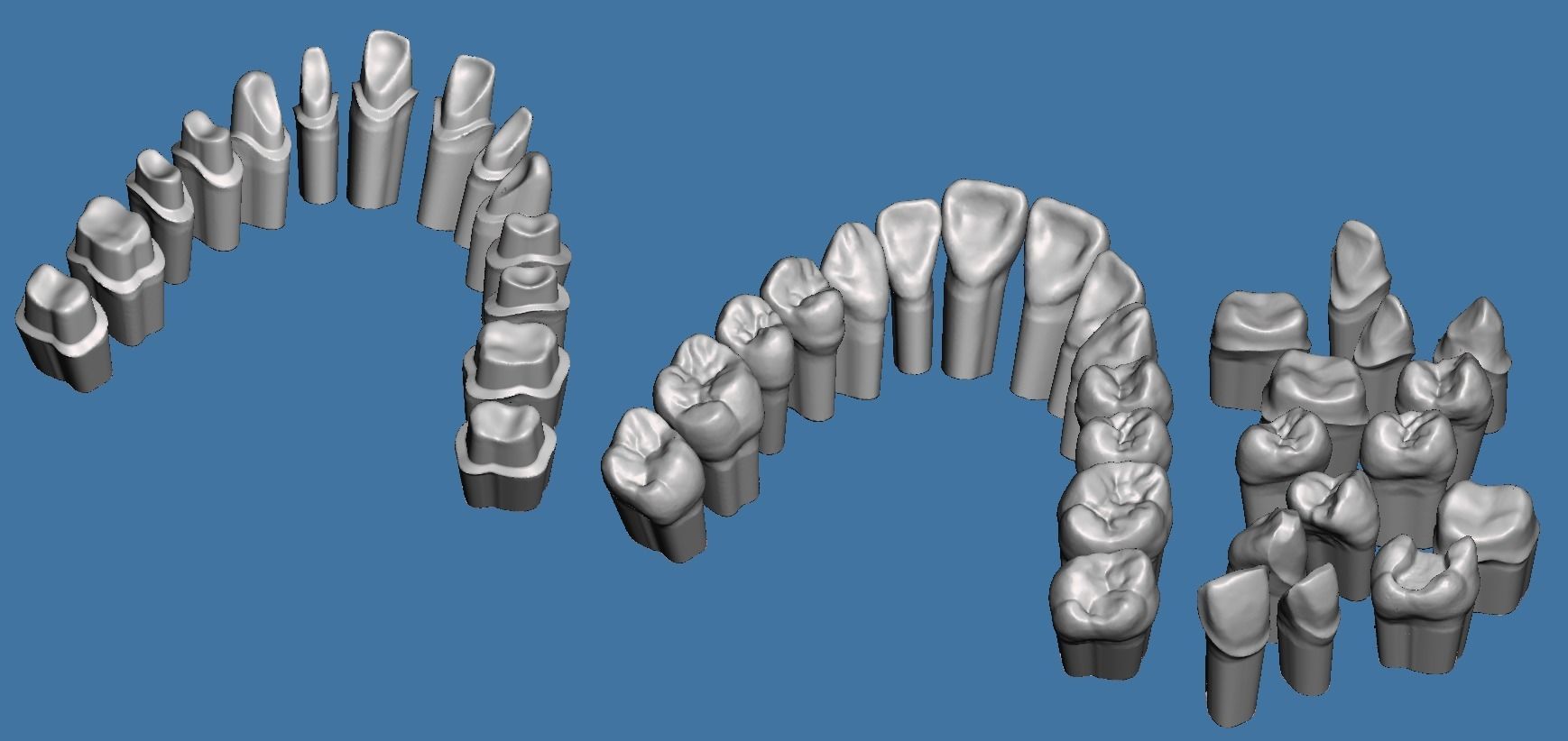 Full die set dental sample model maxillar 3D model 3D printable | CGTrader