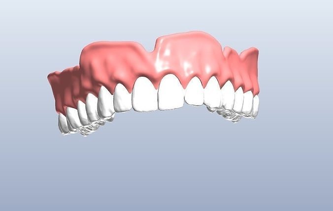 Digital denture bridged teeth 3D model | CGTrader