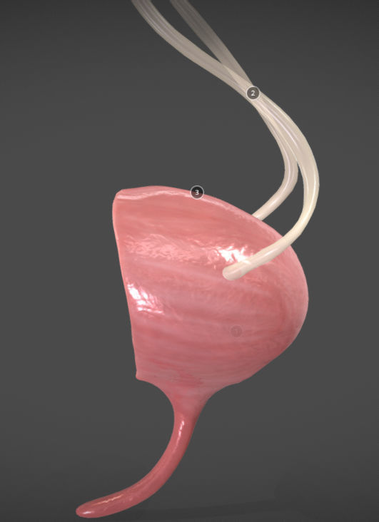 3D model Bladder cancer VR / AR / low-poly | CGTrader