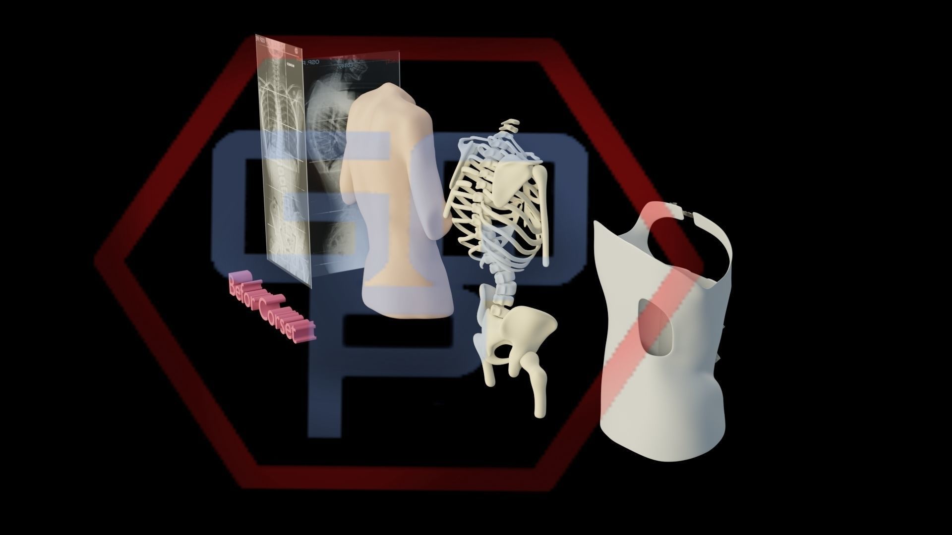 3D model Orthopedic brace corset scoliosis animation VR / AR / low-poly ...