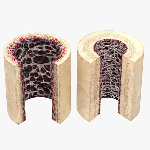 Healthy and Osteoporotic Bone Section 3D model | CGTrader