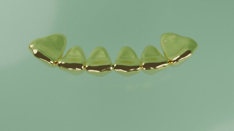 Lower Grillz - gold teeth 3D model | CGTrader