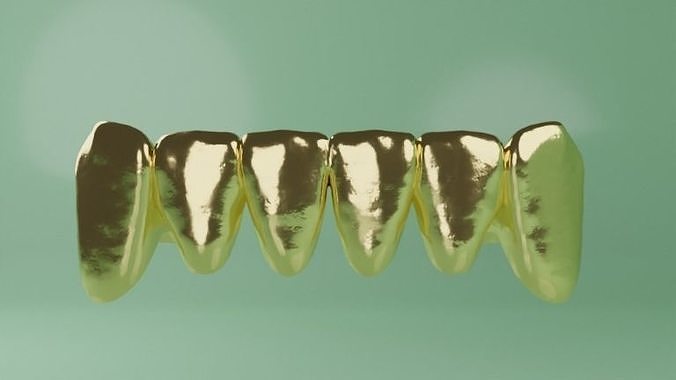 Lower Grillz - gold teeth 3D model | CGTrader