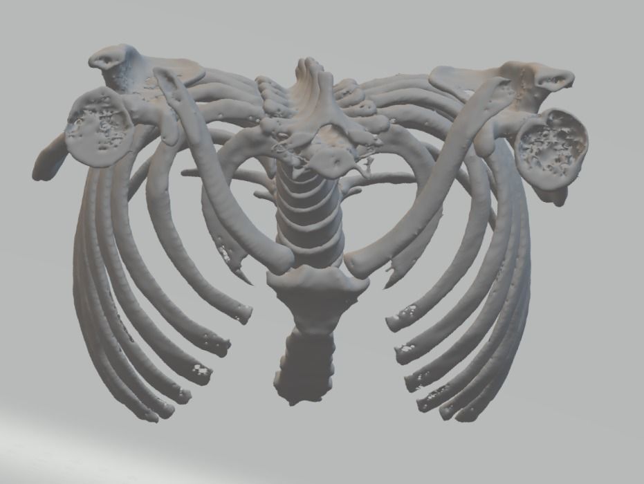 Anatomy Human Rib Cage 3D model 3D printable | CGTrader
