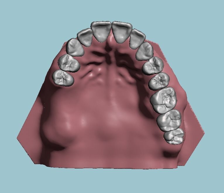 D011 Oral surgery and perio model 3D model 3D printable | CGTrader