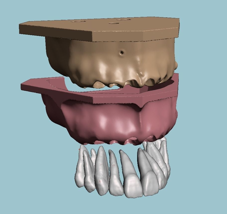 D011 Oral surgery and perio model 3D model 3D printable | CGTrader