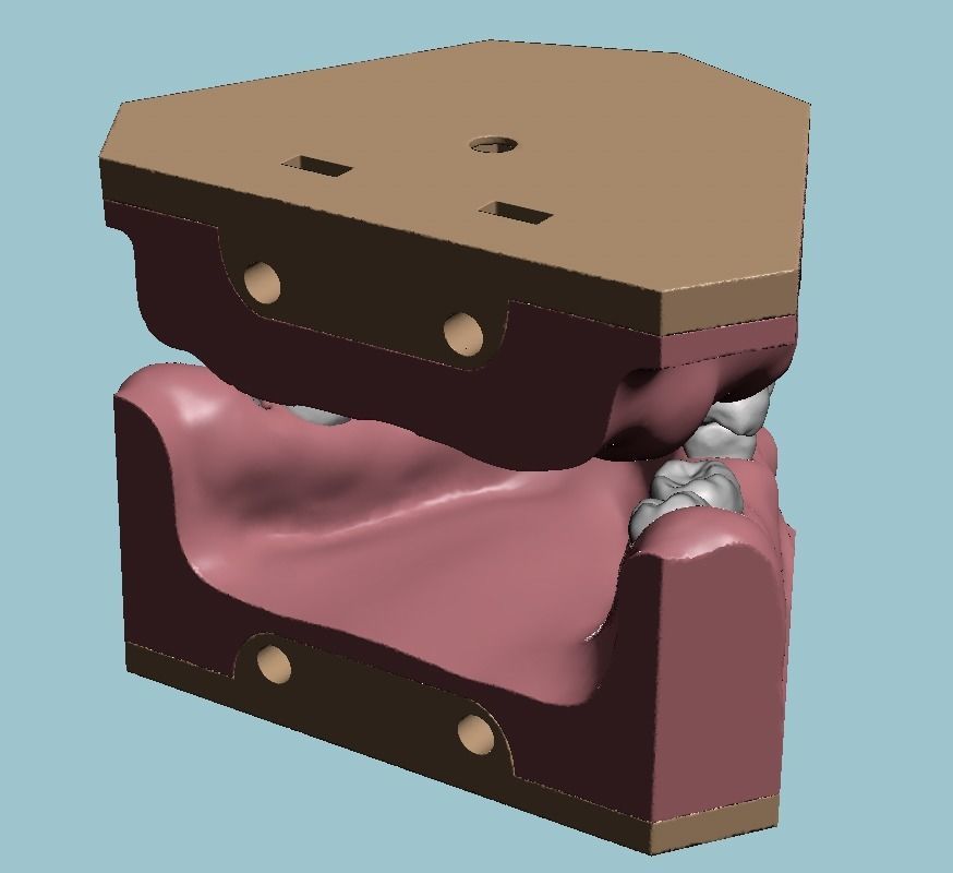 D011 Oral surgery and perio model 3D model 3D printable | CGTrader