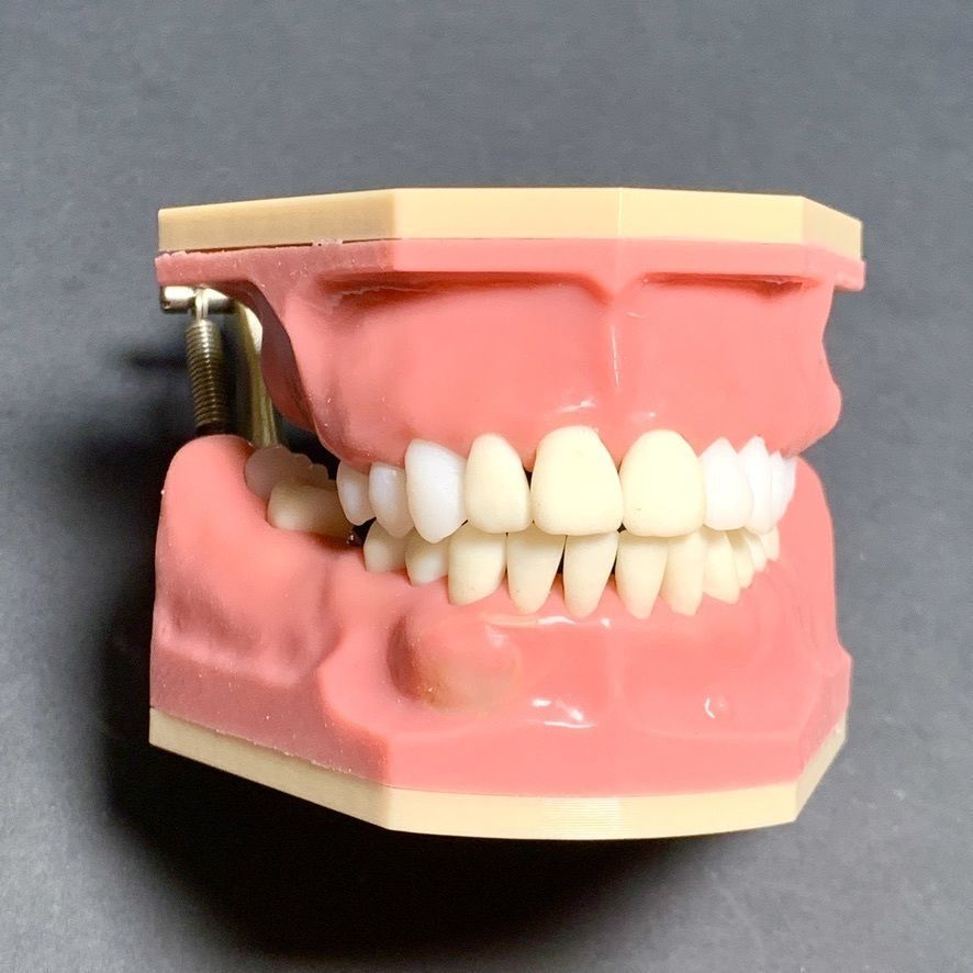 D011 Oral surgery and perio model 3D model 3D printable | CGTrader