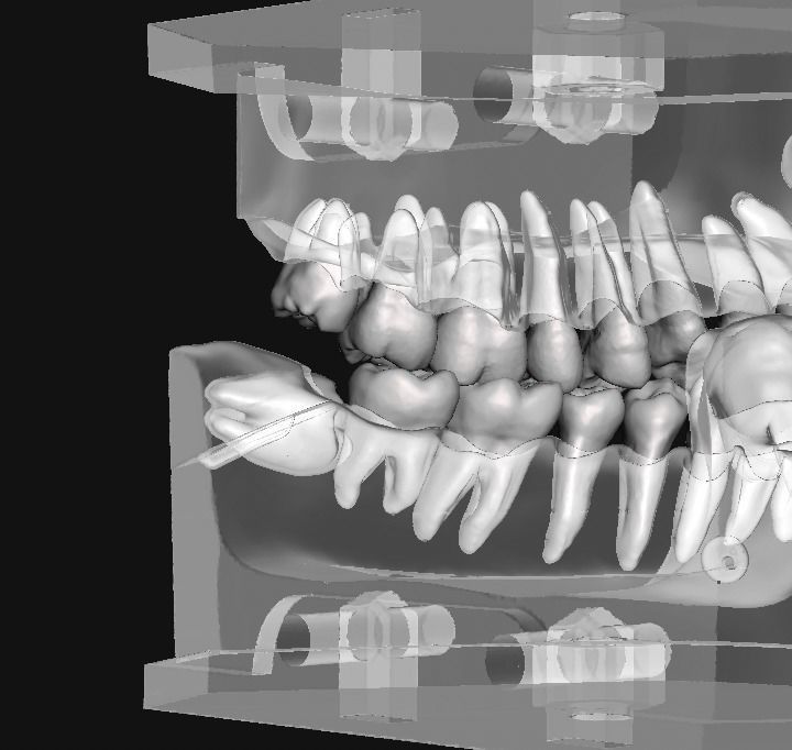 D011 Oral surgery and perio model 3D model 3D printable | CGTrader