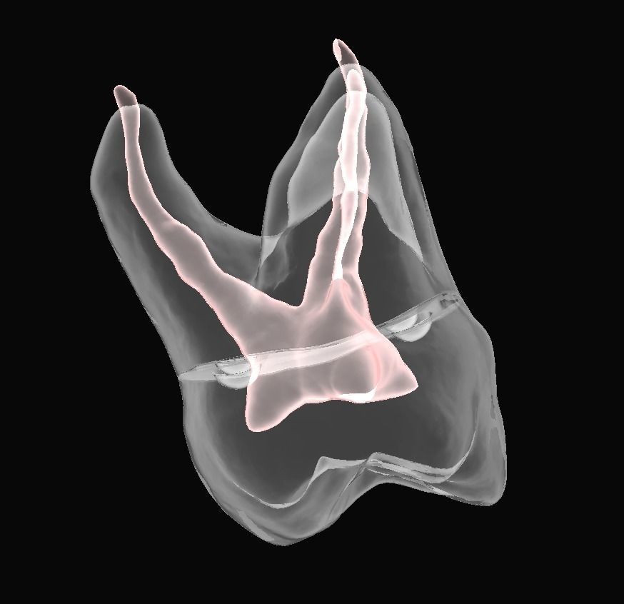 D010 Test model for pulp editing of natural tooth 27 free 3D model 3D ...