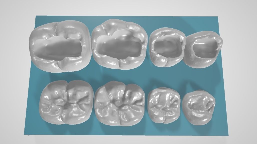 Dental Lower Arch Models 3D print model 3D model 3D printable | CGTrader