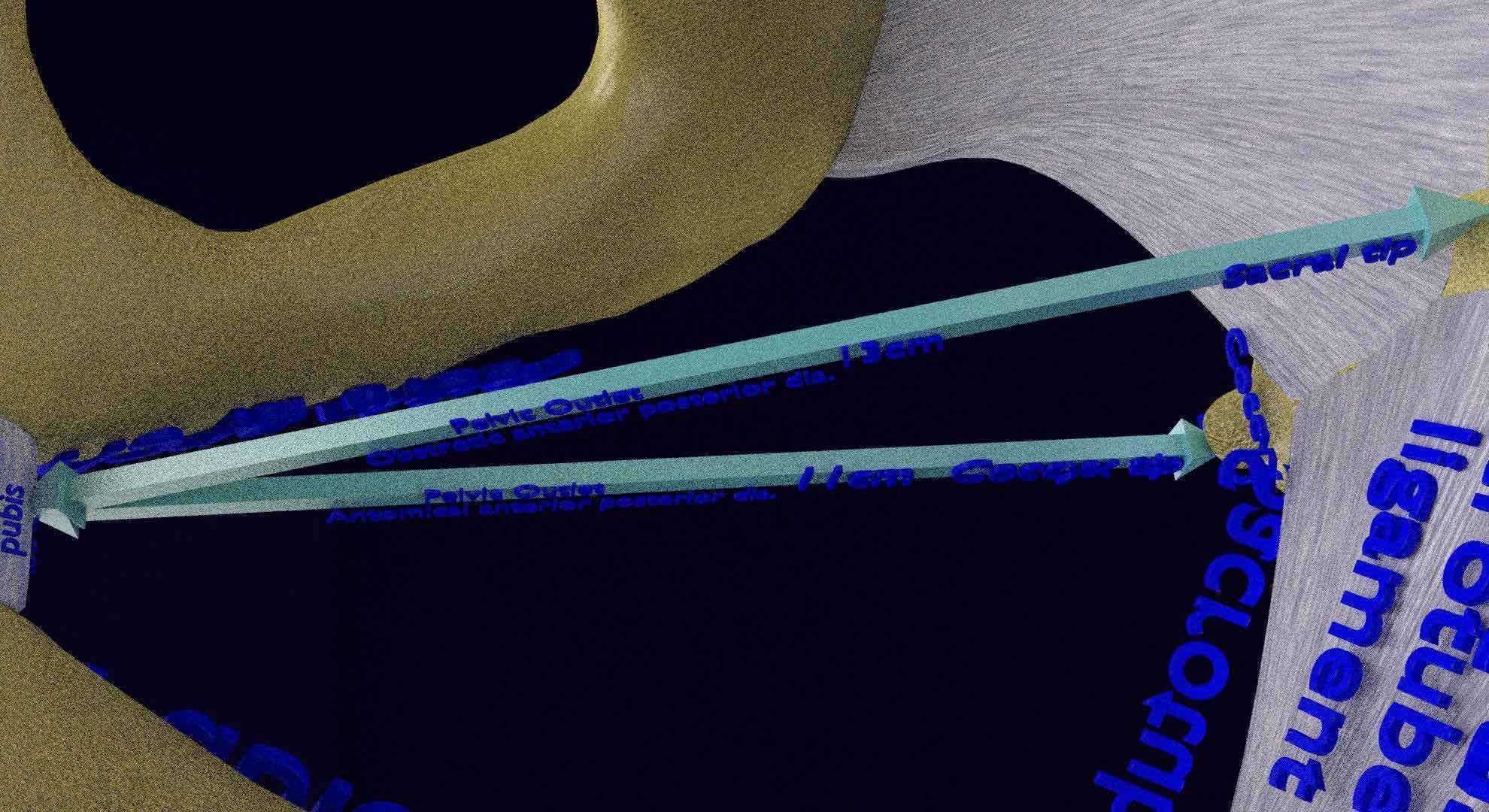 3D model Female pelvis clinical Pelvimetry dimension VR / AR / low-poly ...