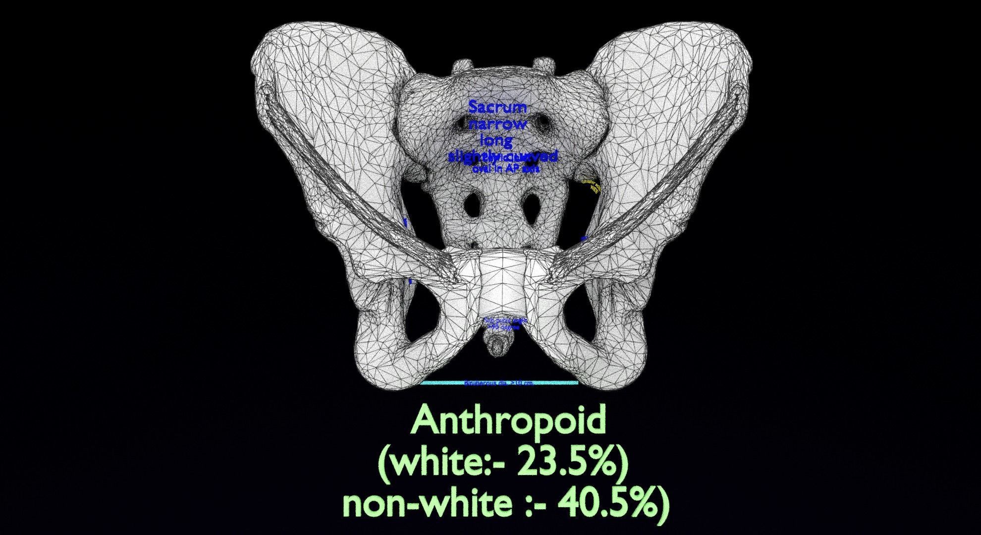 Pelvis types hip bone labelled detailed 3D model animated | CGTrader