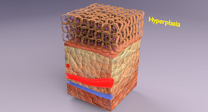 3D model adaptation epithelial cell changes normal to cancer VR / AR ...