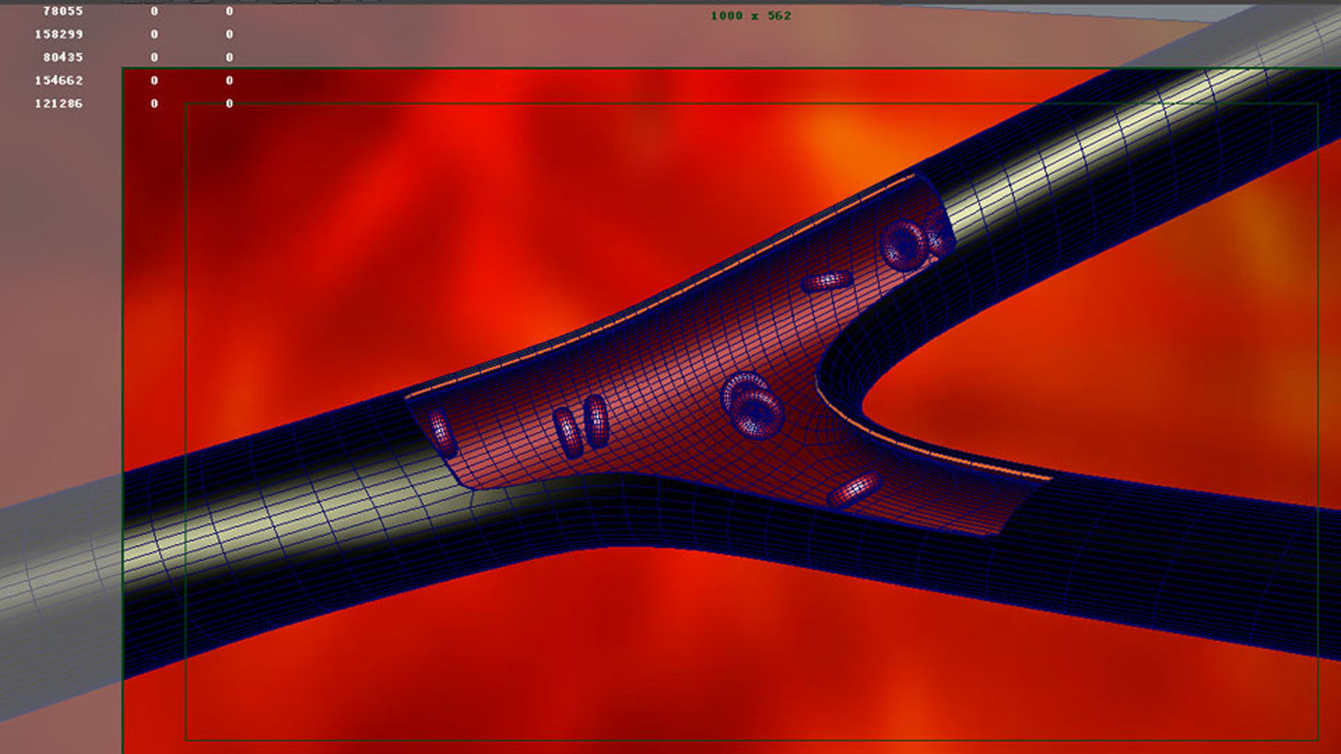 Clog Stream Bloodflow Layers Section Anatomy Artery Vein 3D model ...