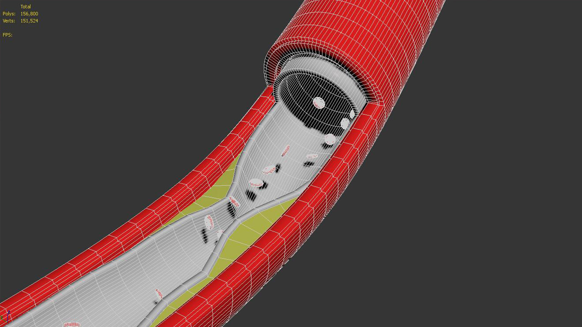 Artery Vein Clog Clot Clogged Stream Bloodflow Layers Section 3D model ...