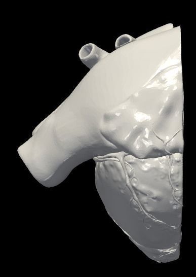 3d model of heart - apical 5 chamber plane 3D model | CGTrader
