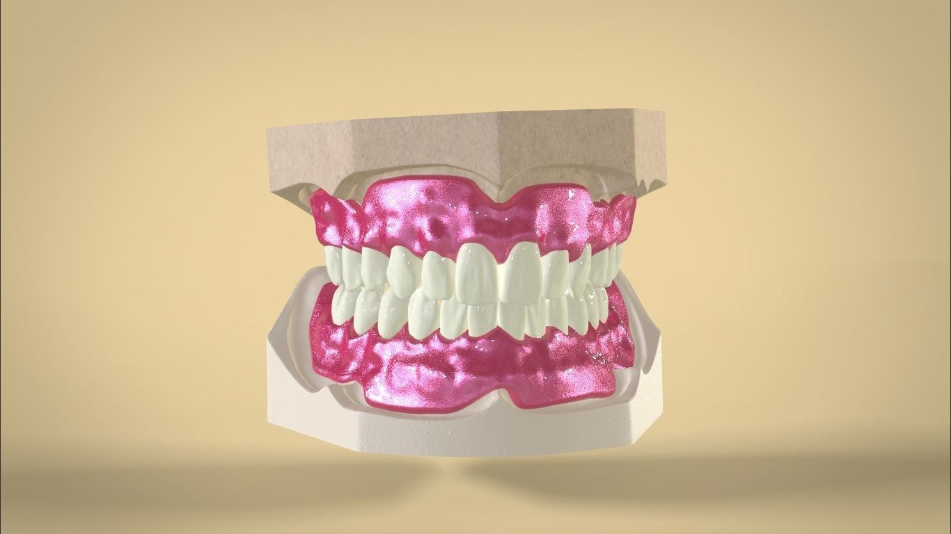 Digital Full Dentures 3D Model 3D printable STL - CGTrader.com