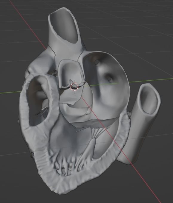 3d model of heart with atrioventricular septal defect 4 chamber 3D ...