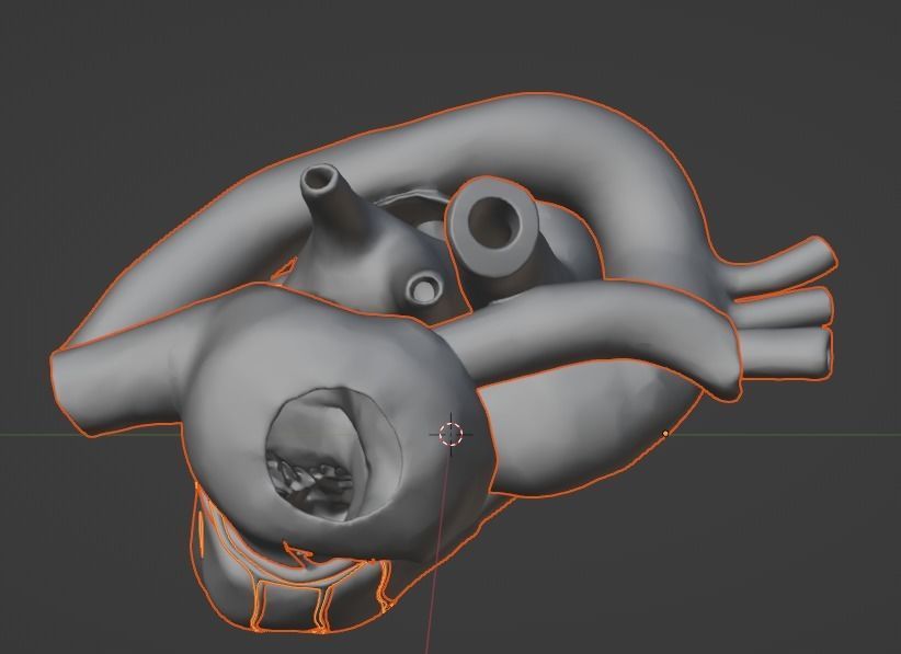 3d model of heart with atrial septal defect 3D model 3D printable ...