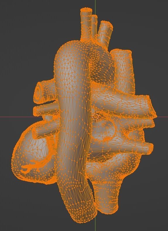 3d model of heart with atrial septal defect 3D model 3D printable ...