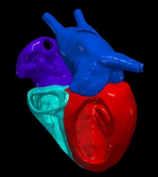 3d model of heart with bicuspid aortic valve 3D model 3D printable ...