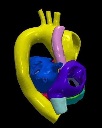 3d model of heart with bicuspid aortic valve 3D model 3D printable ...
