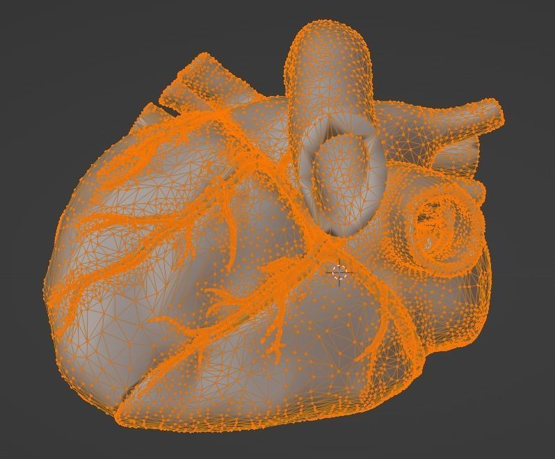 3d model of heart with common arterial trunk 3D model 3D printable ...
