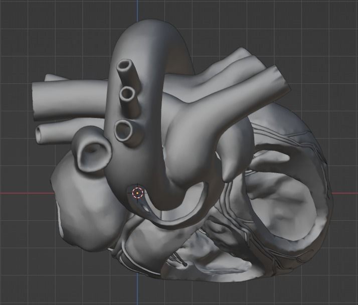 3d model of heart with common arterial trunk 3D model 3D printable ...