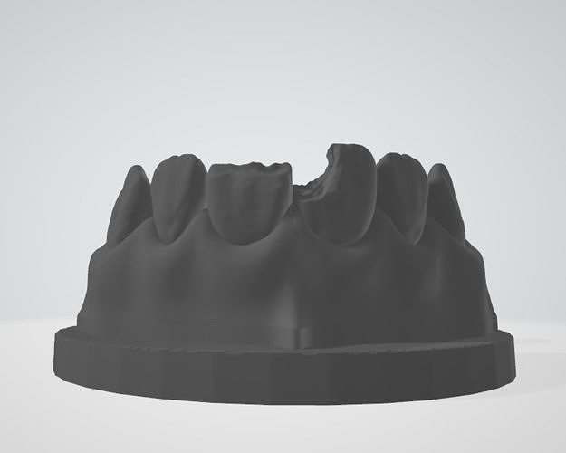 Segmented Anterior Class IV and Class VI by EDM DENTAL PRACTICE 3D ...